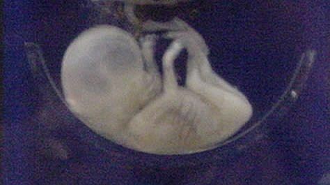 The Blogs: Sorry, liberal Jewish leaders – Judaism is not pro-abortion ...