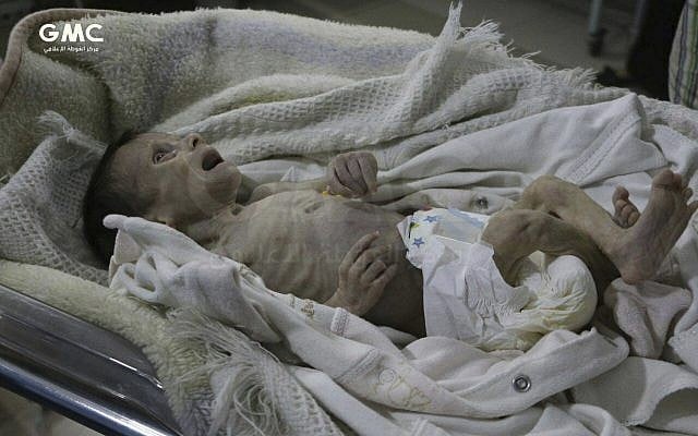 UN 'shocked' by images of 'deliberately starved' Syrian children | The ...