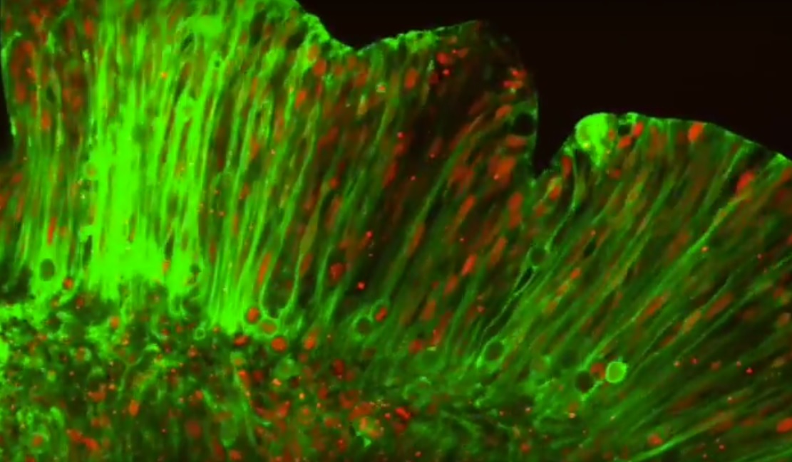 Israeli researchers grow 'mini-brain' in a test tube | The Times of Israel