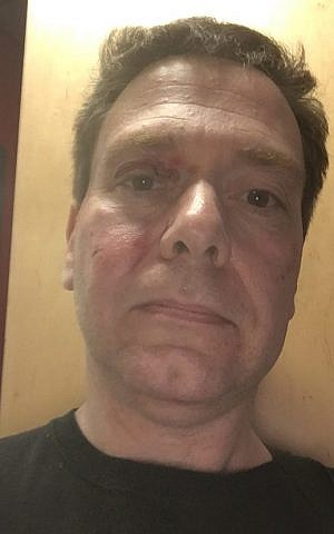 Jewish professor beaten by police says he’ll keep coming back to ...