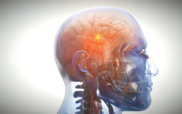 New ALS drug headed to Israel, in first distribution deal outside North ...