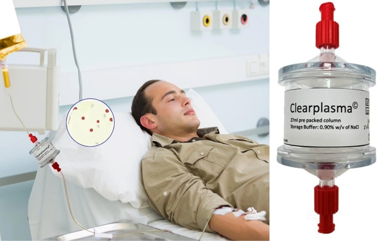 Israeli plasma filter promises cutting-edge solution to life ...