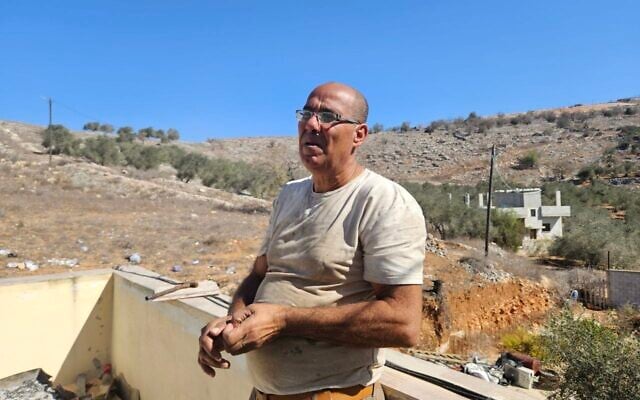 Palestinian hurt by stone-throwing recently spoke to ToI about struggle ...