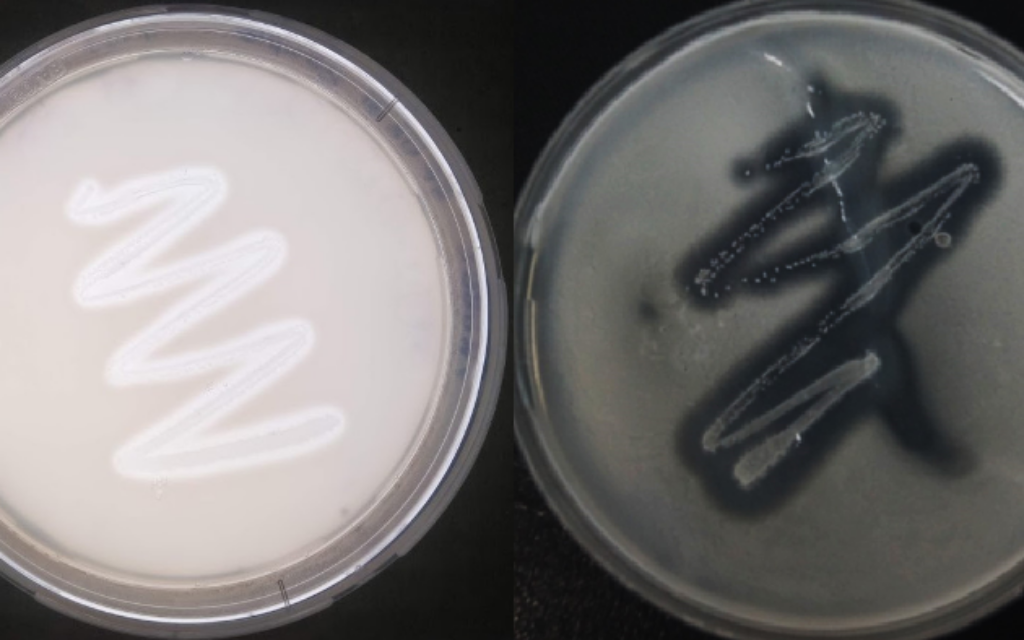 Israeli team pioneers bacteria 'factories' to produce medicine inside ...