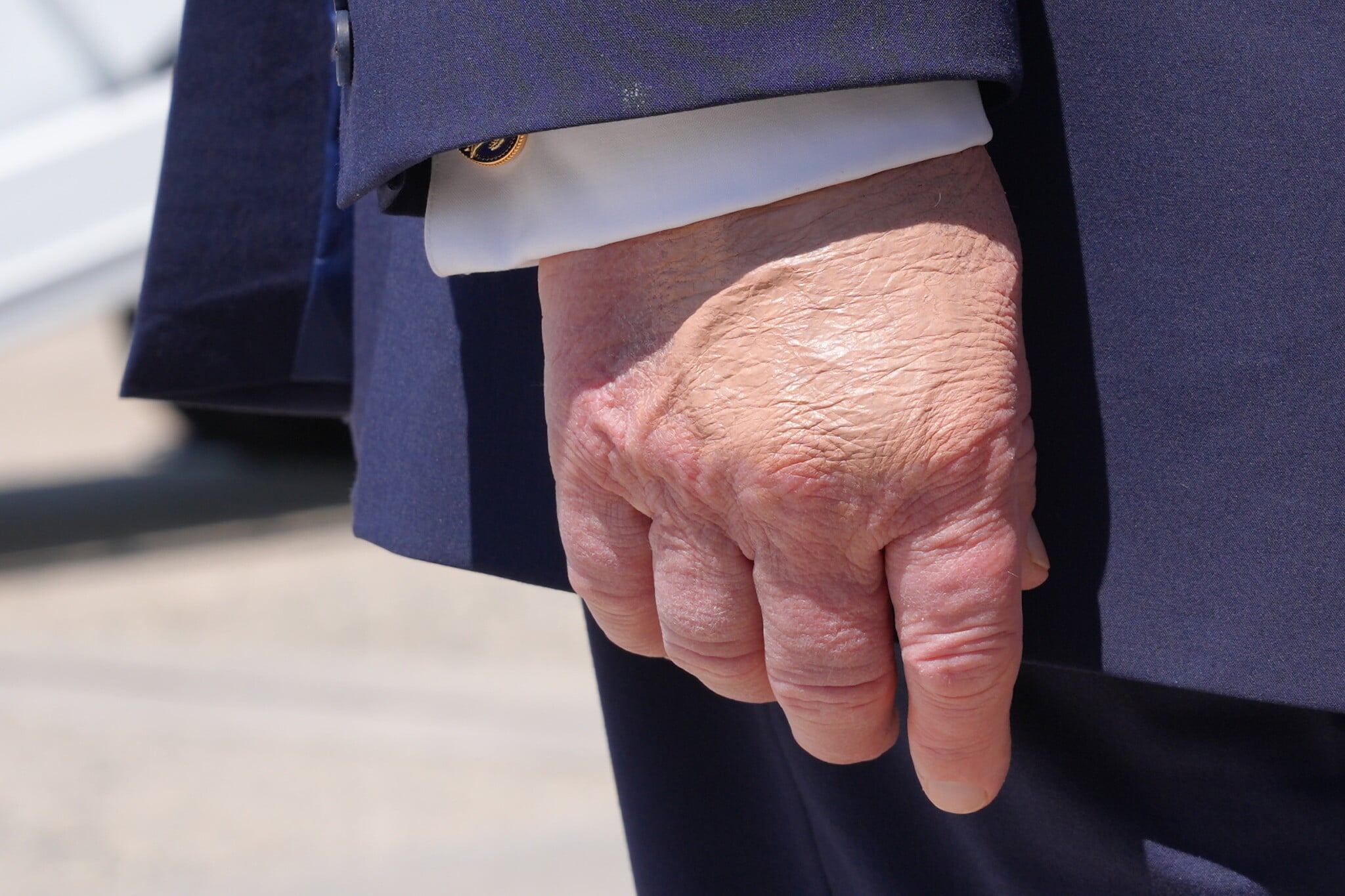 Trump in excellent health, doctor says, despite leg swelling and hand ...
